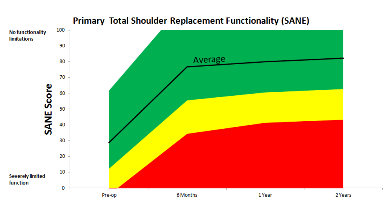 How Fast Will I Recover? | Boston Shoulder Institute